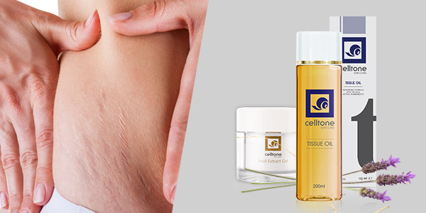 Celltone's Stretch Mark Solution - Celltone